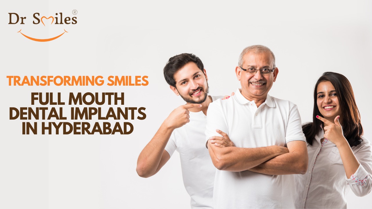 Transforming Smiles: Full Mouth Dental Implants in Hyderabad @ Dr Smiles
