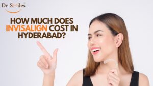 Invisalign Cost in Hyderabad - Dr Smiles