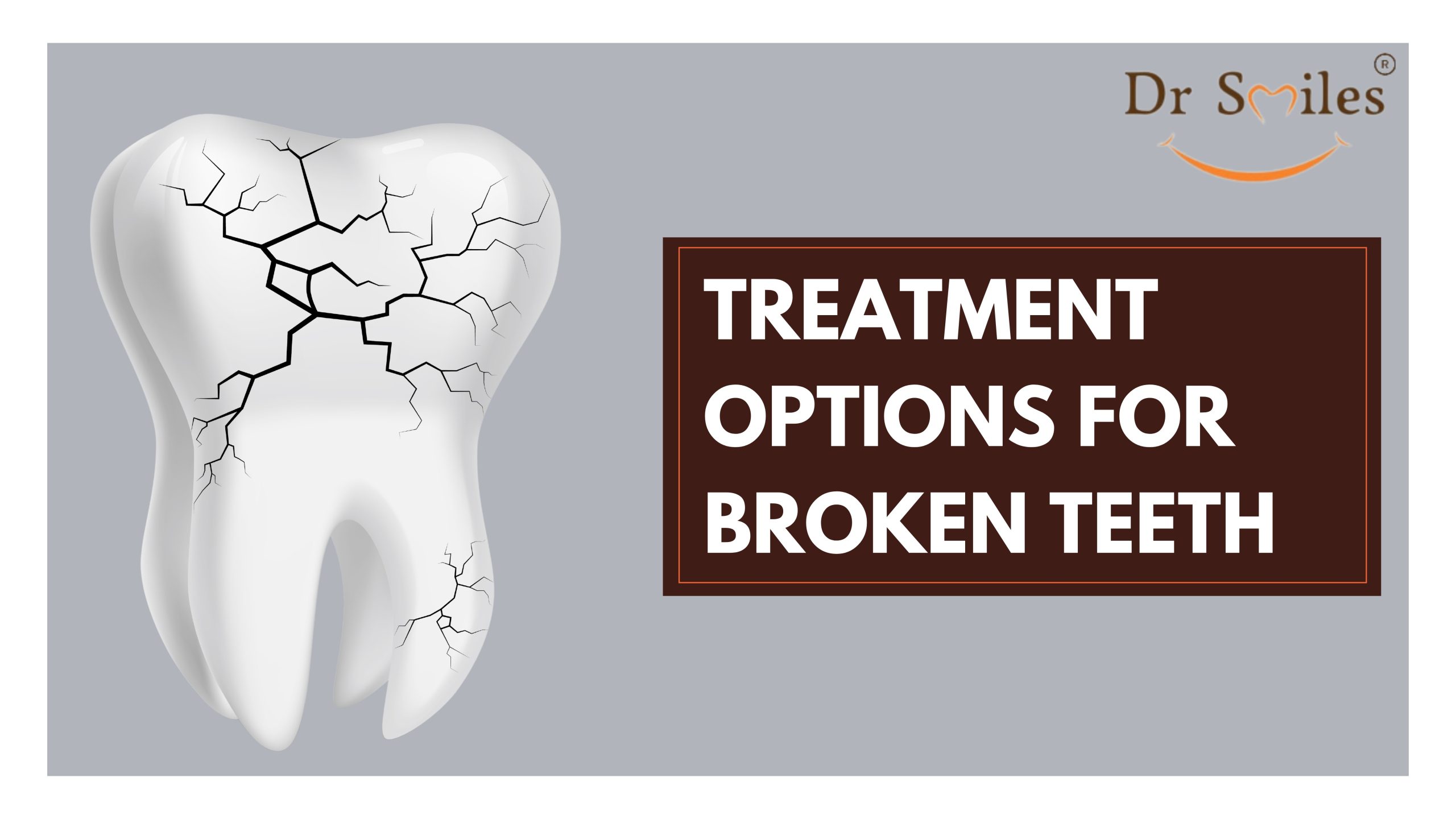 Treatment Options for Broken Teeth: From Bonding to Crowns
